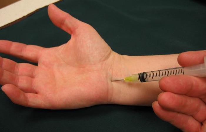 Blog | Corticosteroid Injections for Carpal Tunnel Syndrome Blog | Corticosteroid Injections for Carpal Tunnel Syndrome
